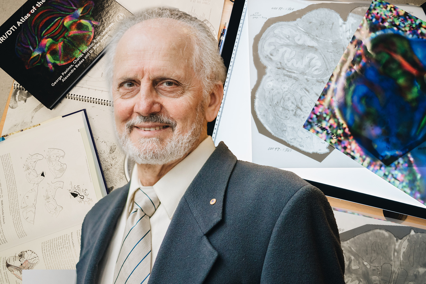 Terra incognita: Neurovědci objevili skrytou oblast v lidském mozku ...