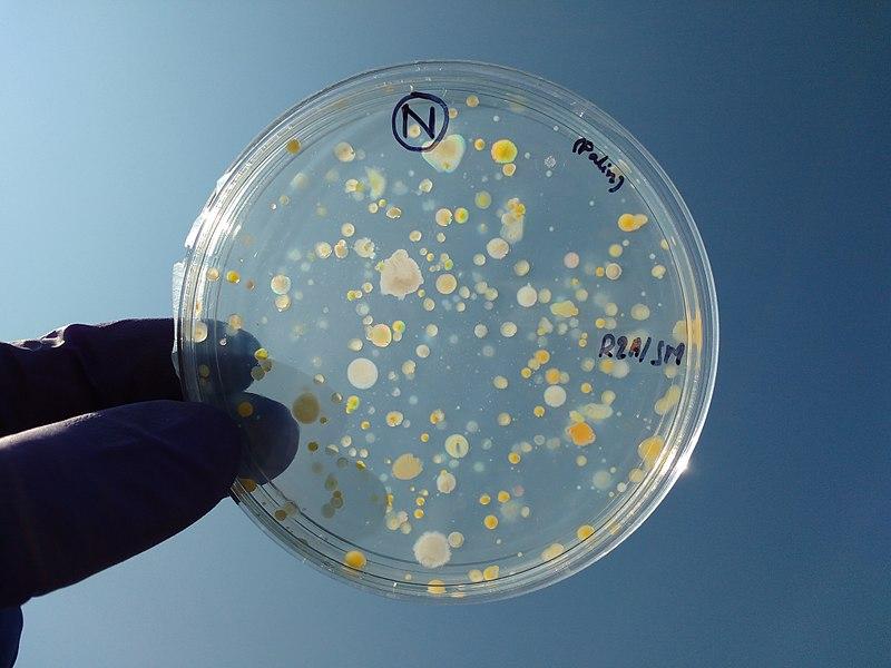 Nedávno objevený fabimycin ničí přes 300 různých rezistentních bakterií ...