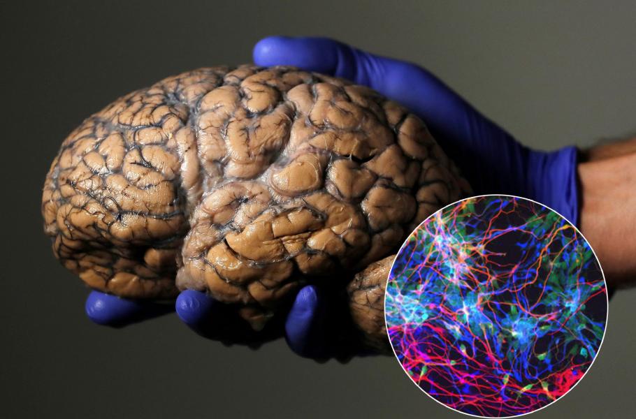 Nově objevené geny mohou za to, že lidé mají tak veliký mozek | 100+1 ...